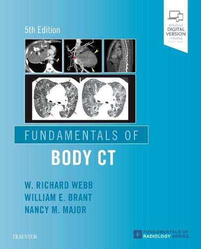 Best Reading Ct Scans For Dummies 2024 Where to Buy? Tutorials-DB.com