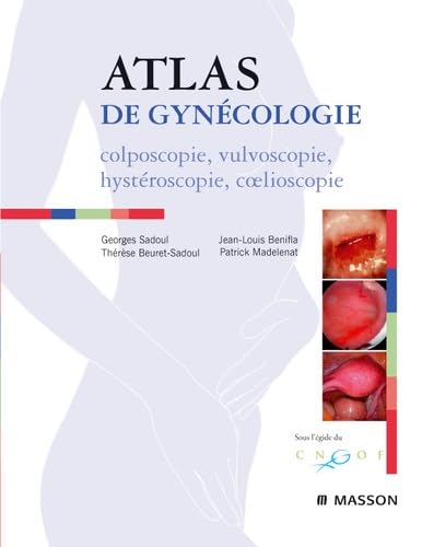 Atlas de gynécologie: colposcopie - vulvoscopie - hystéroscopie ...