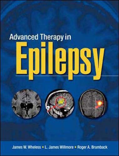 Advanced Therapy in Epilepsy: 9781607950042: Medicine & Health Science ...