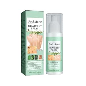 Amazon.com: Back Acne Spray Treatment - 2% Salicylic Acid for Body, Tea ...