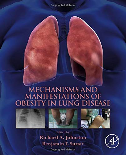 Mechanisms and Manifestations of Obesity in Lung Disease: 9780128135532 ...