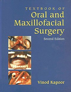 Textbook of Oral & Maxillofacial Surgery 2/e: Kapoor: 9788186809082 ...
