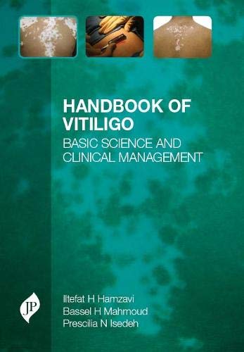 Handbook of Vitiligo: Basic Science and Clinical Management ...