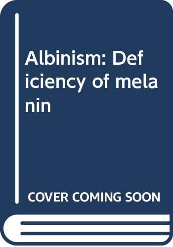 Albinism: unknown author: 9786130151218: Amazon.com: Books