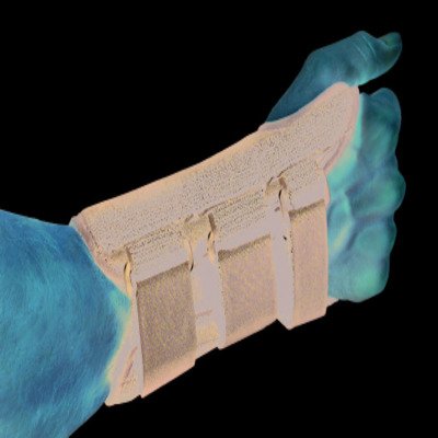 Amazon.com: Mck72873000 - Djo Global Wrist Splint Procare Comfortform ...