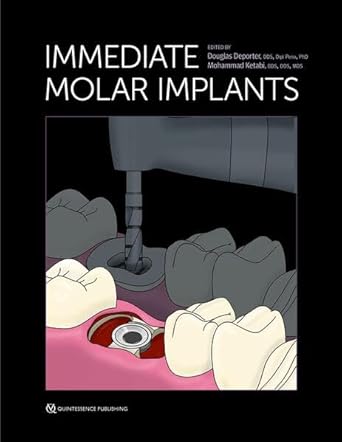 Immediate Molar Implants: 9780867159547: Medicine & Health Science Books @ Amazon.com