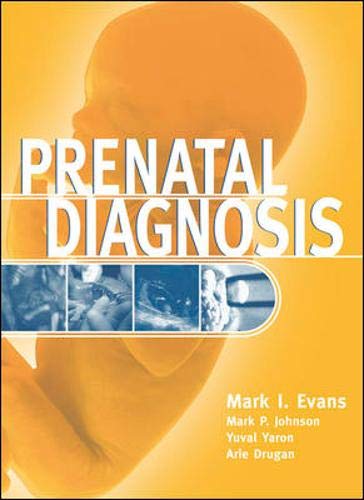 Prenatal Diagnosis: 9780838576823: Medicine & Health Science Books ...