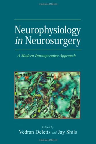 Amazon.com: Neurophysiology in Neurosurgery: A Modern Intraoperative ...
