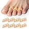 Amazon.com: Welnove Hammer Toe Corrector and Straightener - 8 Pcs Toe ...