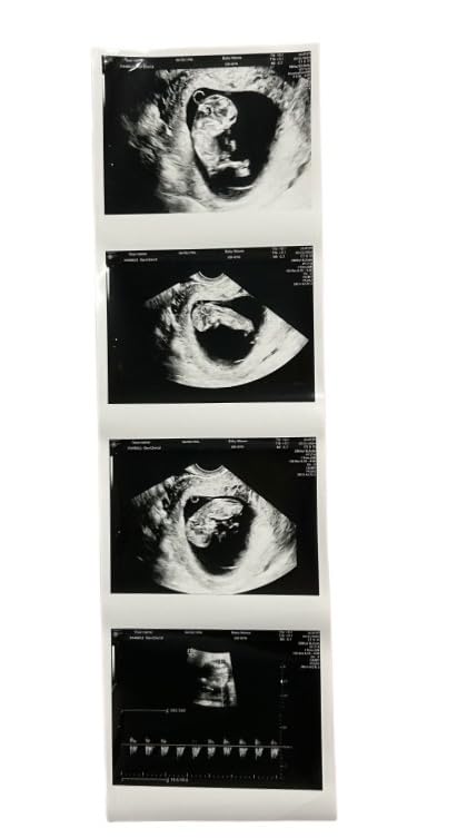 Amazon.com: Personalized Pregnancy Prank Ultrasound Photos | Customized ...