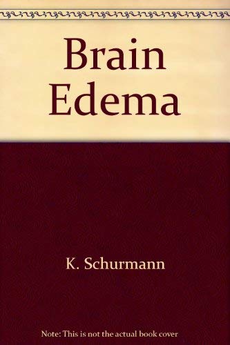 Brain Edema: Cerebello Pontine Angle Tumors, Diagnosis and Surgery ...