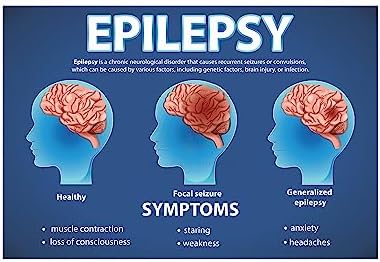Anne Print Solutions® Epilepsy chart Poster Size 13 X 19 Inch* Without ...