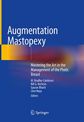 Augmentation Mastopexy: Mastering the Art in the Management of the ...