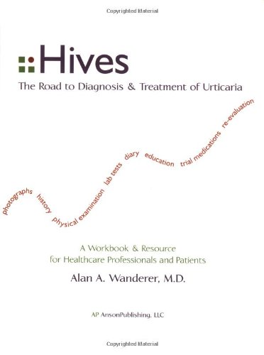 Hives: The Road to Diagnosis and Treatment of Urticaria: Amazon.co.uk ...