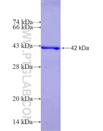 Amazon.com: Human CIDEB Fusion Protein : Industrial & Scientific