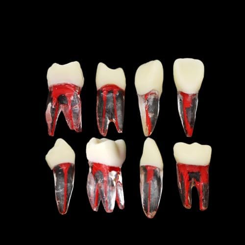 Amazon.com: 10Pcs Dental Root Canal Pulp Cavity RCT Practice Endodontic ...