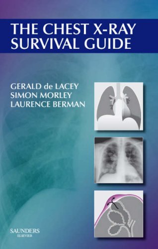 Buy The Chest X-ray Survival Guide Book Online at Low Prices in India ...