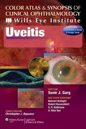 Uveitis: Color Atlas and Synopsis of Clinical Ophthalmology (Wills Eye ...