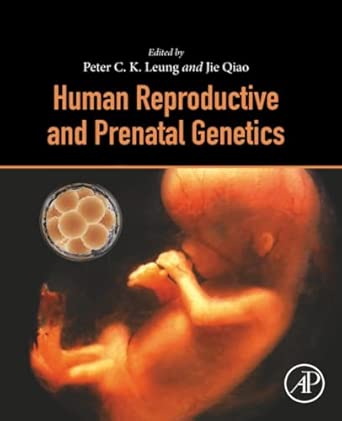 Human Reproductive and Prenatal Genetics: 9780128135709: Medicine ...