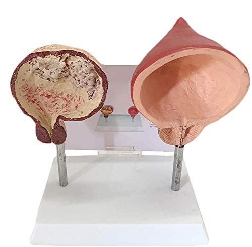 Human Urinary System Model Anatomical Bladder Model Comparison Model Of ...
