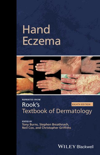 Buy Hand Eczema Book Online at Low Prices in India | Hand Eczema ...