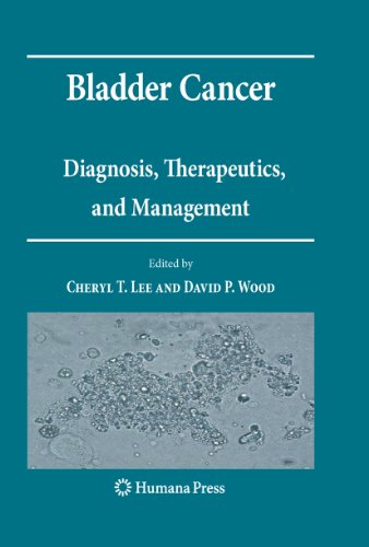 Amazon.com: Bladder Cancer: Diagnosis, Therapeutics, and Management ...