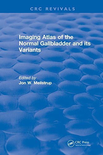 Imaging Atlas of the Normal Gallbladder and Its Variants eBook ...