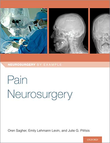 Pain Neurosurgery (Neurosurgery by Example) - Kindle edition by Sagher ...