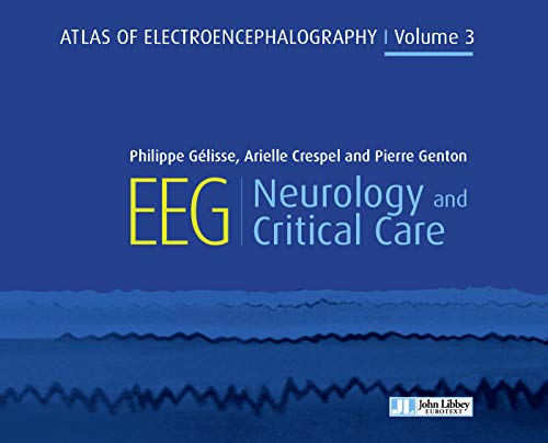 EEG : Neurology and Critical Care (Atlas EEG Book 3) eBook : Gélisse ...