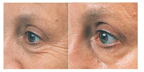 DerMAXYL Mezclar con su crema favorita, gel, loción o suero para hacer ...