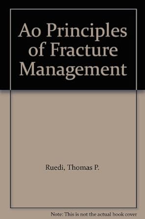 Ao Principles of Fracture Management: Ruedi, Thomas P.: 9781588900982 ...