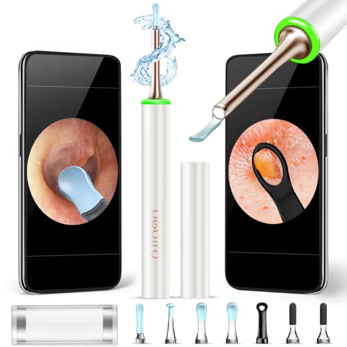 Find The Best Zit Popping Videos Ever Reviews & Comparison - Katynel