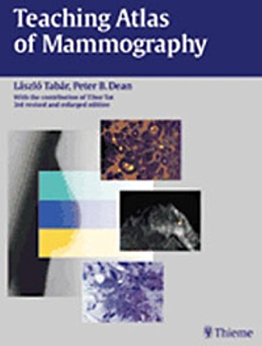 Teaching Atlas of Mammography: Tabar, Laszlo: 9783136408032: Amazon.com ...