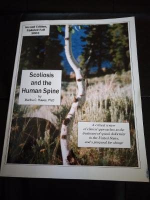 Scoliosis And the Human Spine : Hawes, Martha: Amazon.co.uk: Books