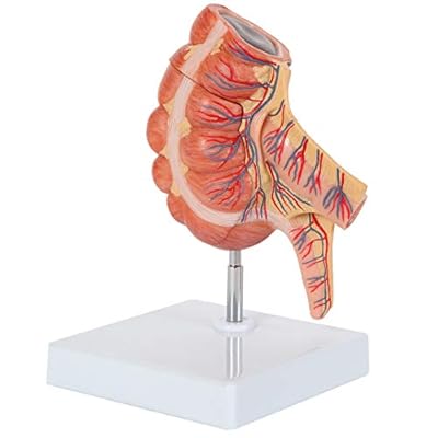 Axis Scientific Caecum and Appendix Anatomy Model - Australia | Ubuy