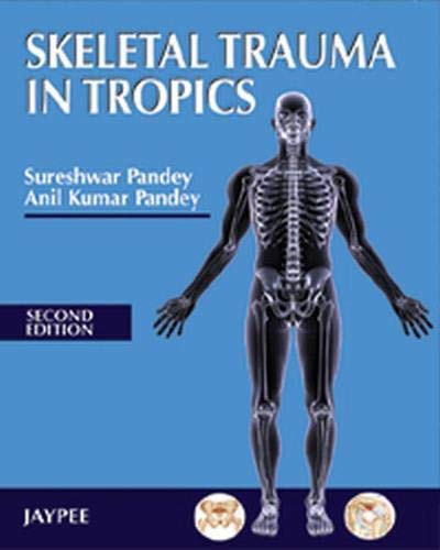 Skeletal Trauma in Tropics: Amazon.co.uk: Pandey, Sureshwar ...