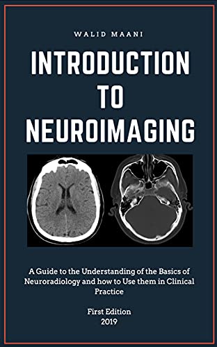 Introduction to Neuroimaging: A guide to the understanding of the ...