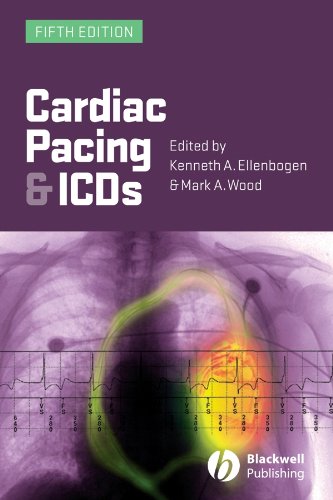 Amazon.com: Cardiac Pacing and ICDs eBook : Ellenbogen, Kenneth A ...