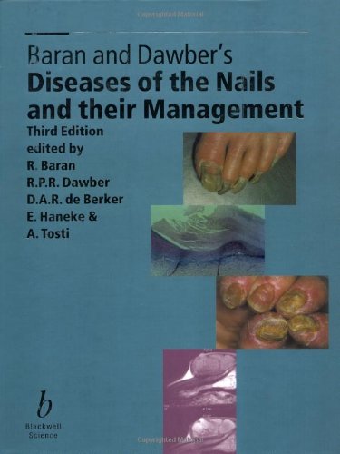 Diseases of the Nails and Their Management: 9780632053582: Medicine ...