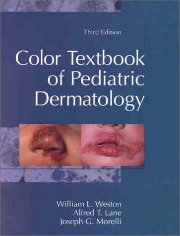 Color Textbook Of Pediatric Dermatology, 3/E : Weston W.L.: Amazon.in ...