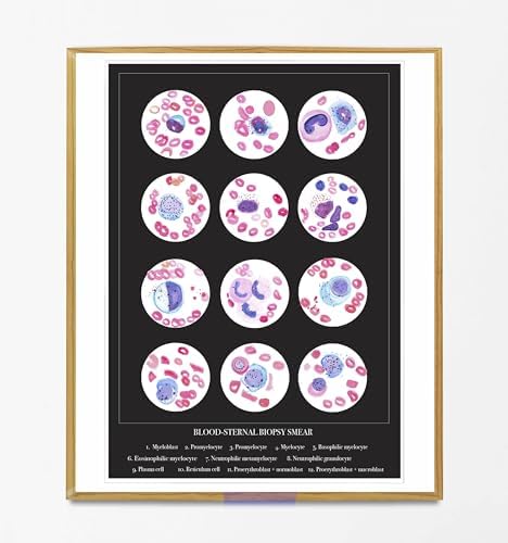 Amazon.com: Blood Cell Art, Laboratory Artwork, Laboratory Decor ...