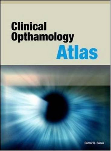 Clinical Ophthalmology Atlas: Medicine & Health Science Books @ Amazon.com