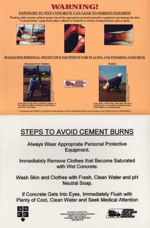 Cement Burn Poster: Amazon.com: Industrial & Scientific