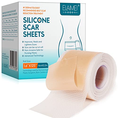 Narben behandeln mit Narbenpflastern: So geht’s!