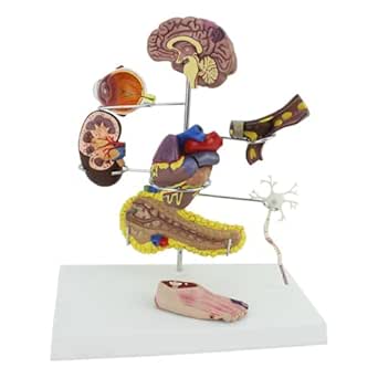 Diabetes Model Set,Human Diabetic Pathology Model, 8 Components, Foot ...