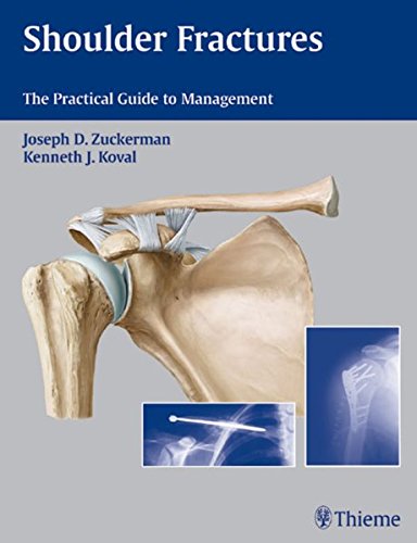 Shoulder Fractures: The Practical Guide to Management: 9781588903105 ...