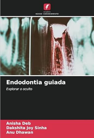Amazon.co.jp: Endodontia guiada: Explorar o oculto : Deb, Anisha, Sinha ...
