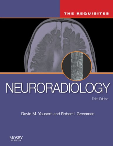 Neuroradiology: The Requisites (Requisites in Radiology) eBook ...