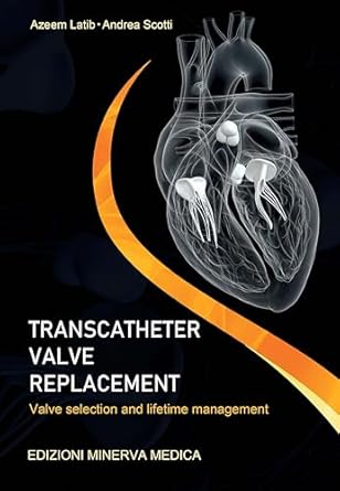 Transcatheter valve replacement. Valve selection and lifetime ...