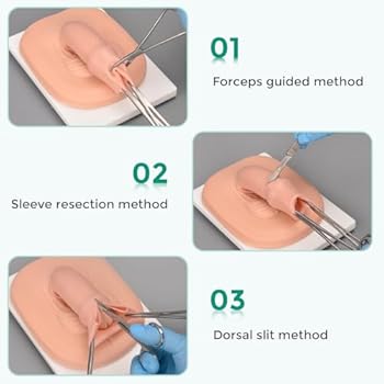 Male Circumcision Procedure Medical Circumcision Device Urology Use